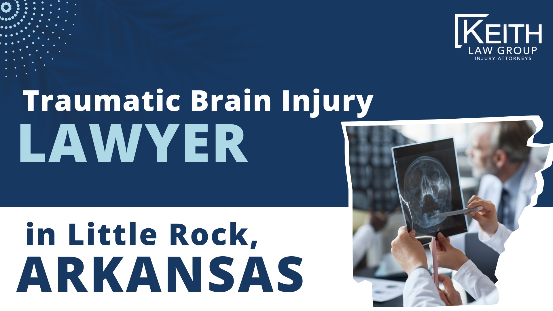 Little Rock Traumatic Brain Injury Lawyer | Keith Law Group